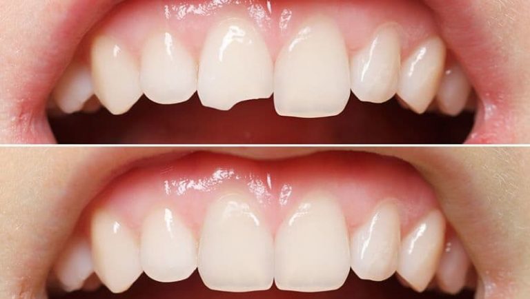 Restorasi dan Kosmetik Gigi – Dental Office By Dr. Peiter
